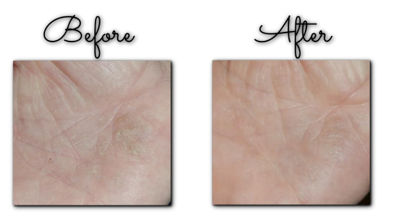 O’Keeffe’s Working Hands & Healthy Feet Review! @okeeffescompany #Works